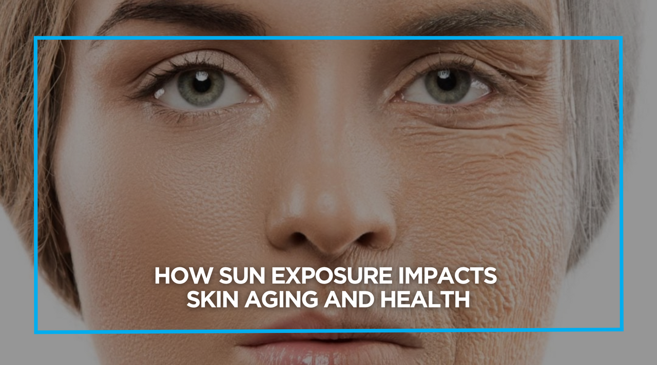 How Sun Exposure Impacts Skin Aging and Health – SParms