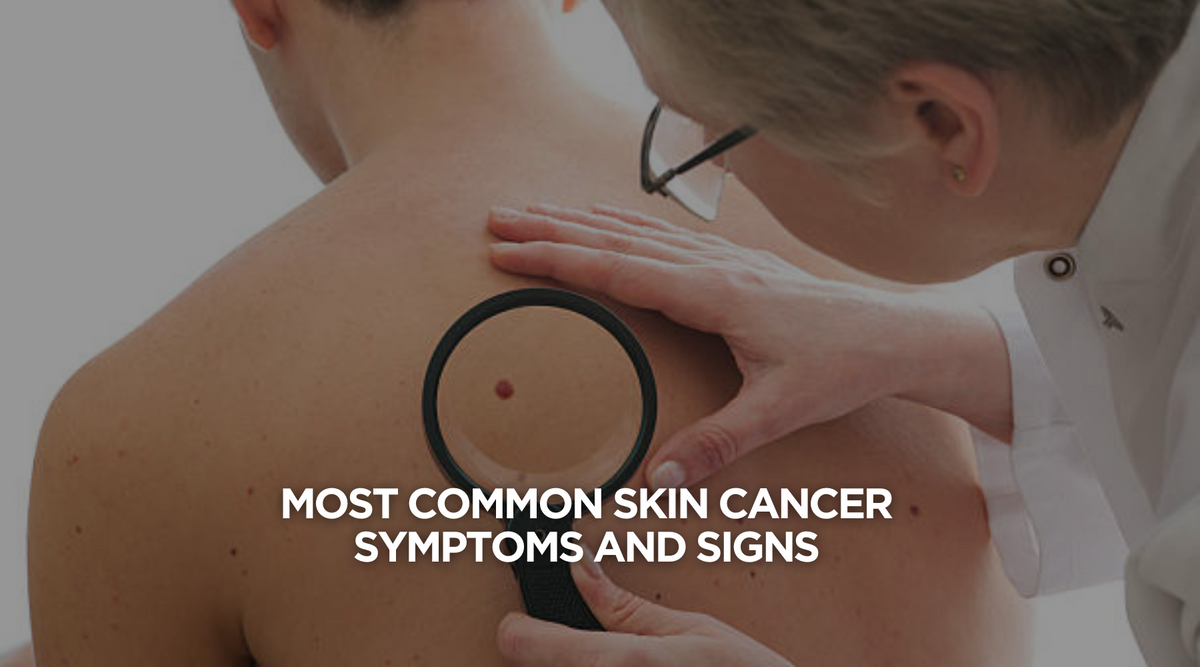 Most Common Skin Cancer Symptoms And Signs Sparms